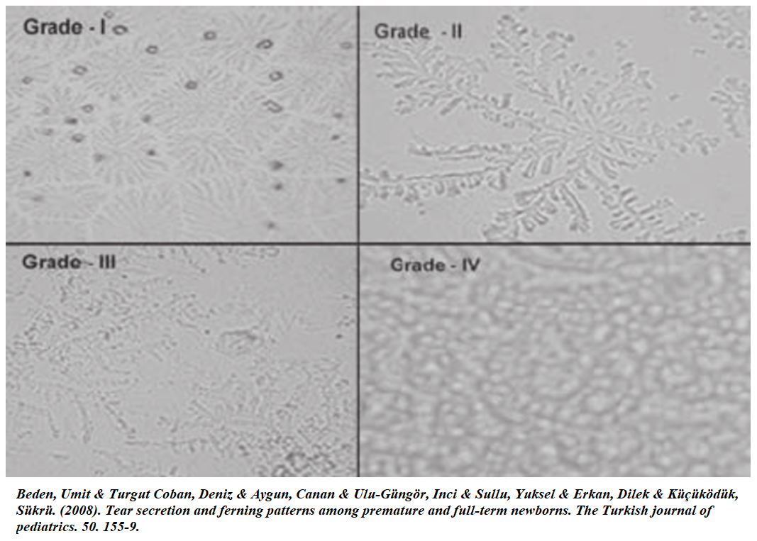 Superficie Ocular – Carrera de Optometría FES Iztacala